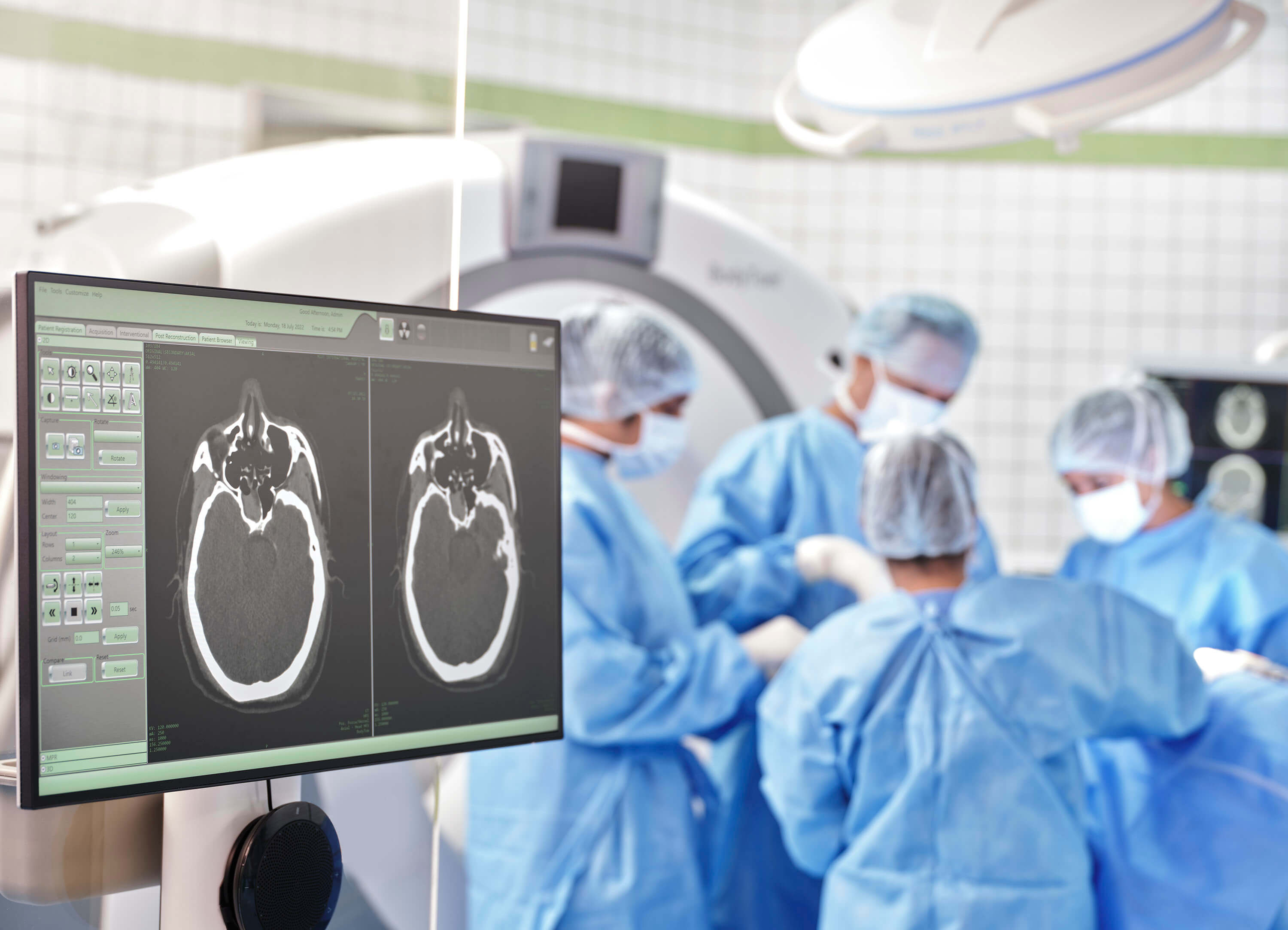 Launching MIOT’s full-body mobile 32-slice CT scan for the 1st time in ...